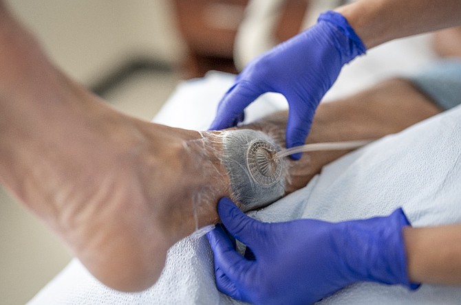 Complex wound care services, which are hard to secure on Medicaid ...